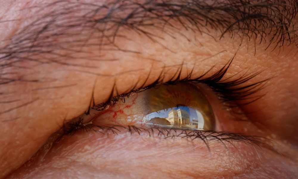 White Flashes In The Corners Of Eyes: Causes & Concerns - Pure Optical